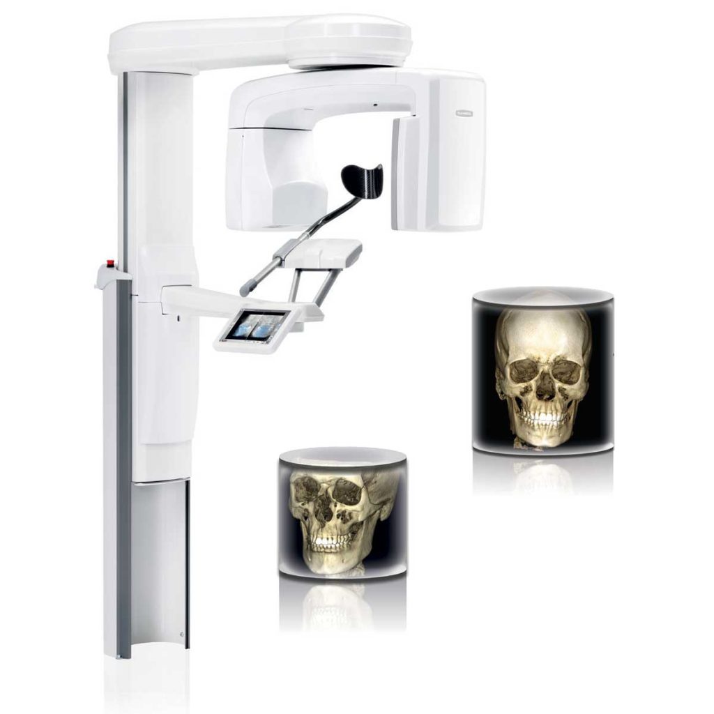 C-Arm X-ray Technology - Implants & Oral Surgery of Chattanooga